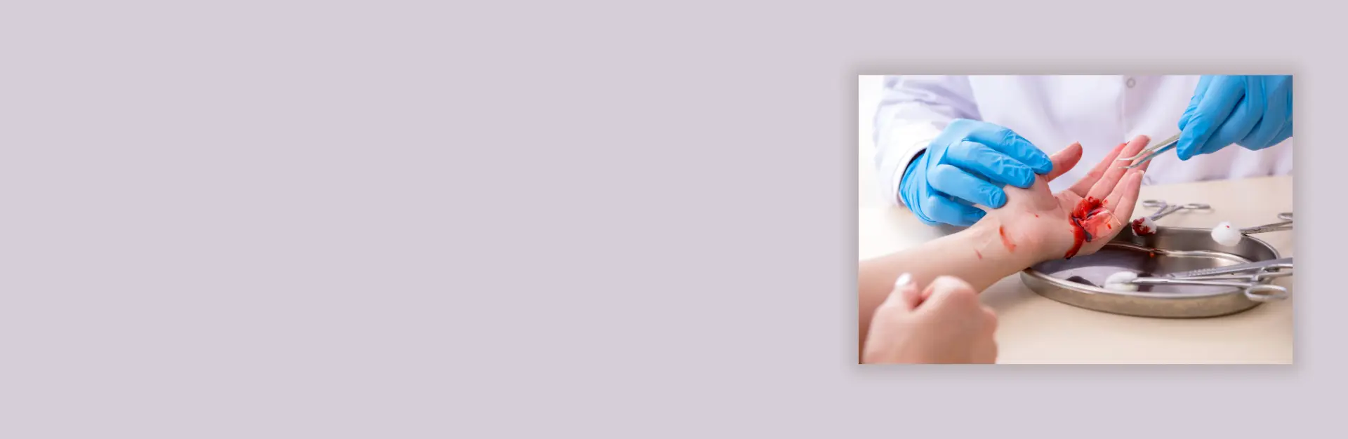 Glass-Cut Injury Treatment in Ahmedabad | Acute Wound & Microsurgery